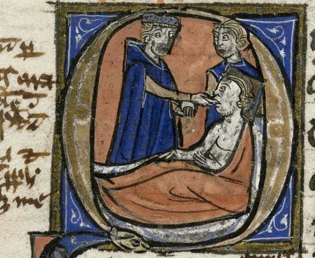 Picture Of Medicine From The Middle Ages Medicine In The Middle Ages